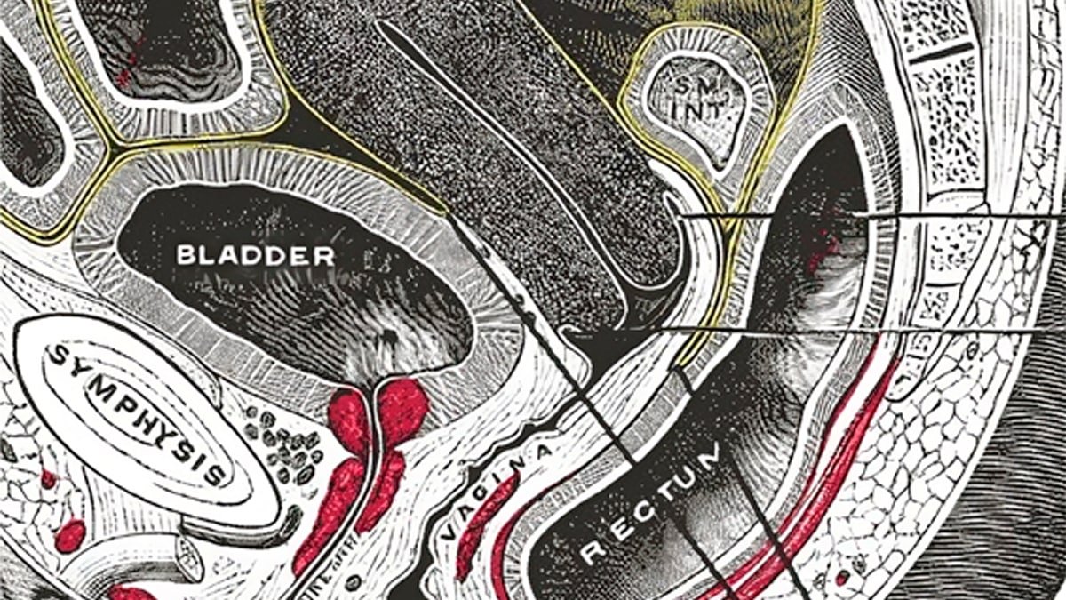 Entenda tudo sobre o saco de Douglas: função, estrutura e importância ...